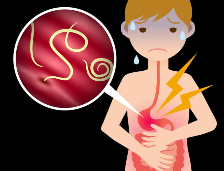 Intruders: Common Types of Intestinal Parasites